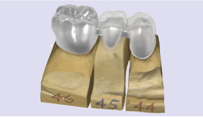 exocad for technicians - Dental CAD Website