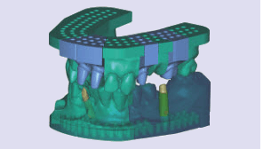 exocad for technicians - Dental CAD Website