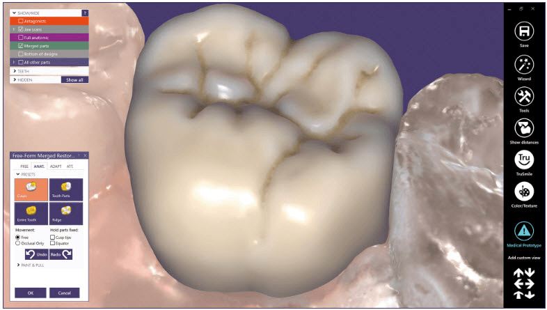exocad for dentists - Dental CAD Website