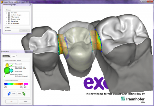 exocad for technicians - Dental CAD Website