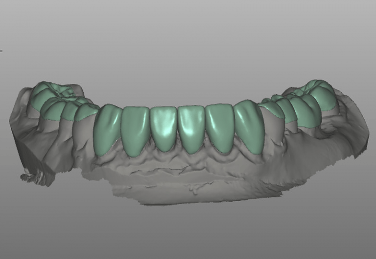 exocad for technicians - Dental CAD Website