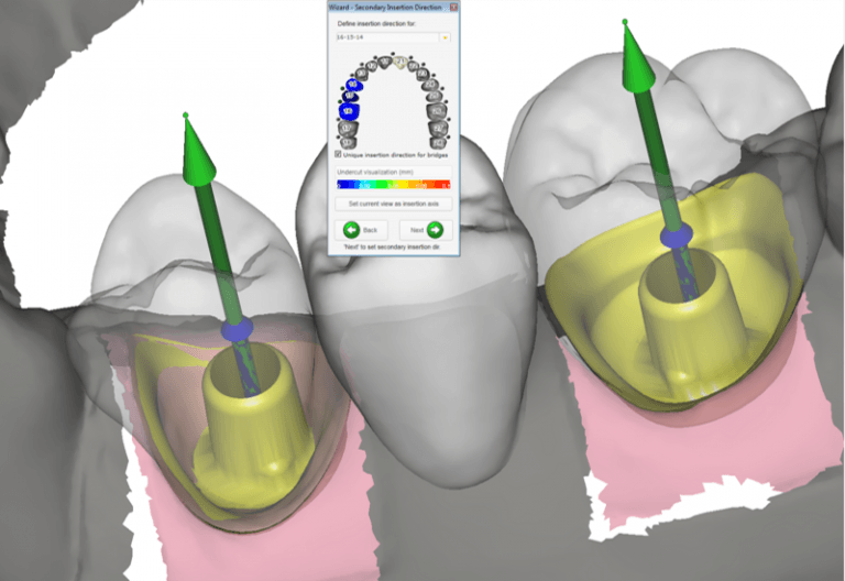 exocad for technicians - Dental CAD Website