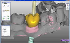 exocad for technicians - Dental CAD Website
