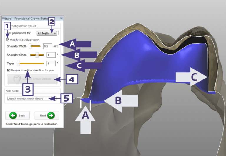 exocad for technicians - Dental CAD Website