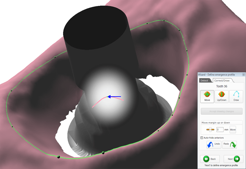 exocad for technicians - Dental CAD Website